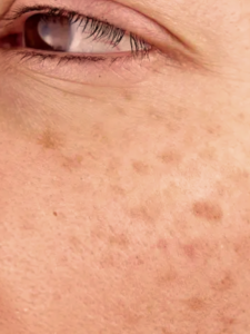 Centre Laser Paris Est